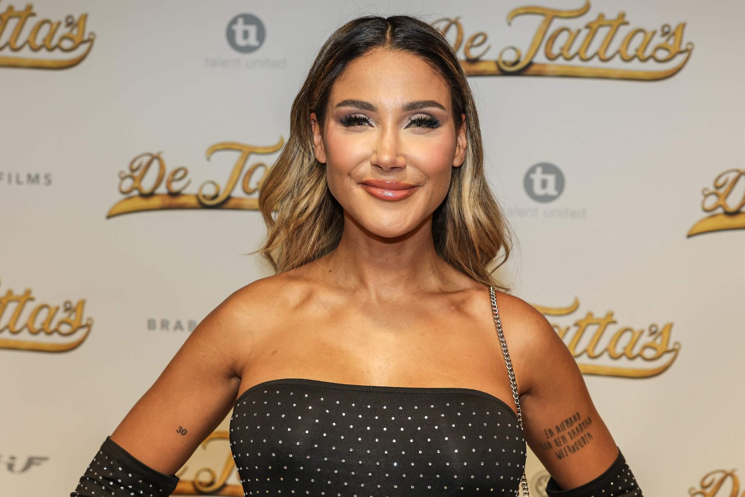 Oh my! Janice Blok onherkenbaar door allergische reactie in gezicht