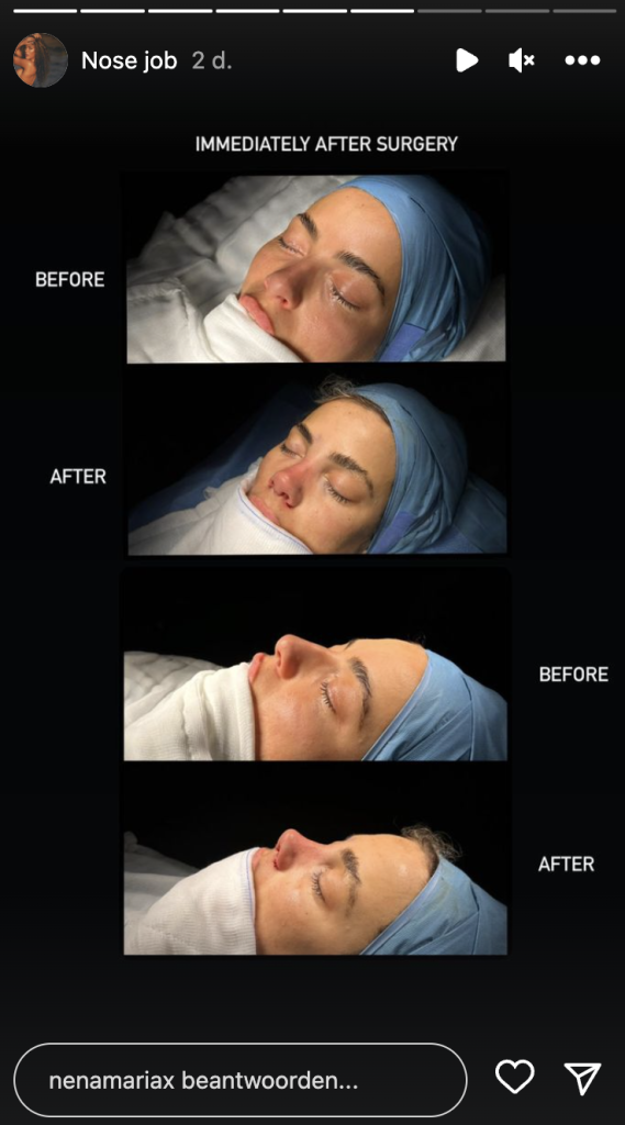 Zien! Temptation-Nena toont resultaat van haar neuscorrectie - Love & Reality